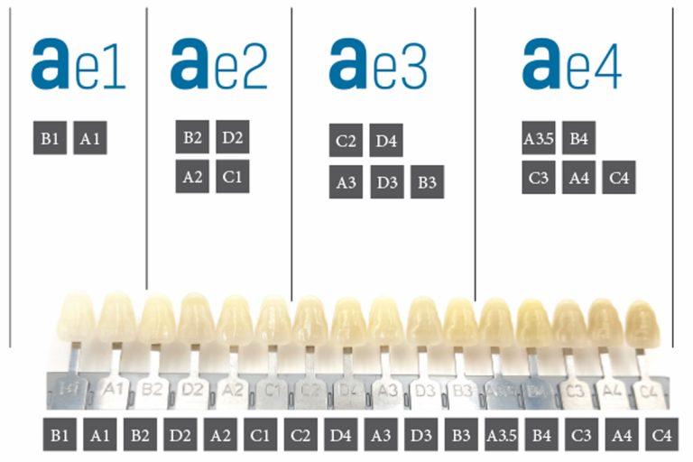 aura easyflow - SDI