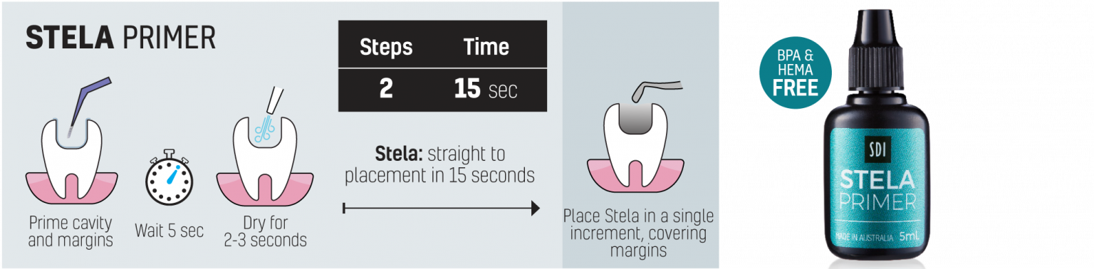 Stela – The true amalgam alternative - SDI
