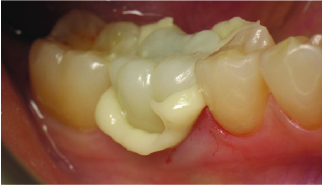Riva Cem Automix - SDI