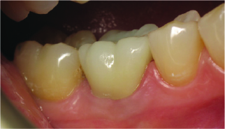 Riva Cem Automix - SDI