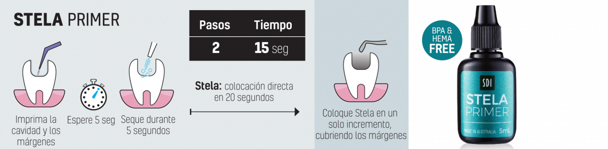 Stela – The true amalgam alternative - SDI